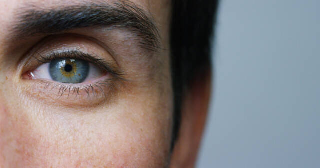 Eye Floaters - Symptoms, Causes and Treatment of Eye Floaters
